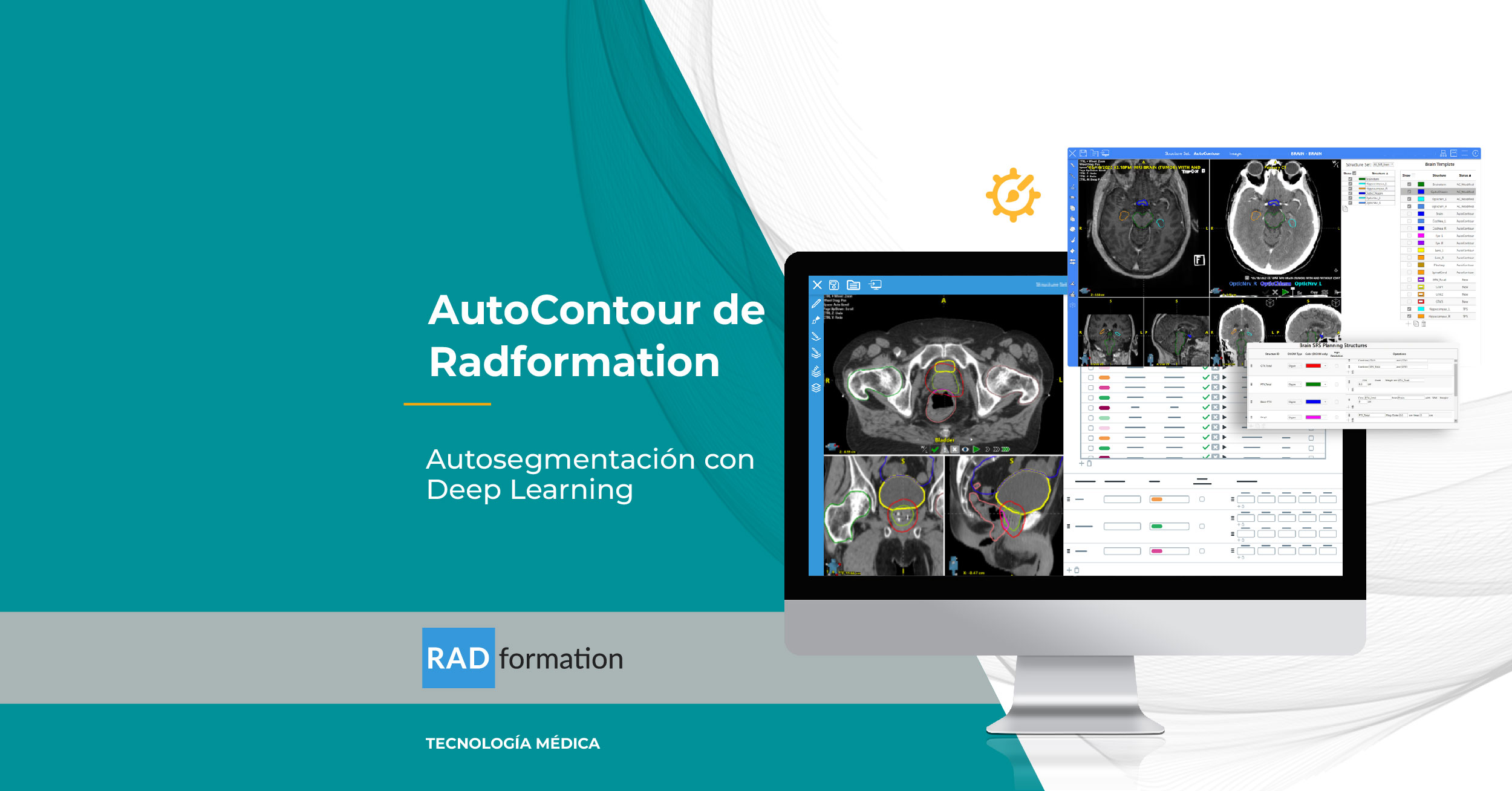 Autocontour - Deep learning para radioterapia- ΔTFísica