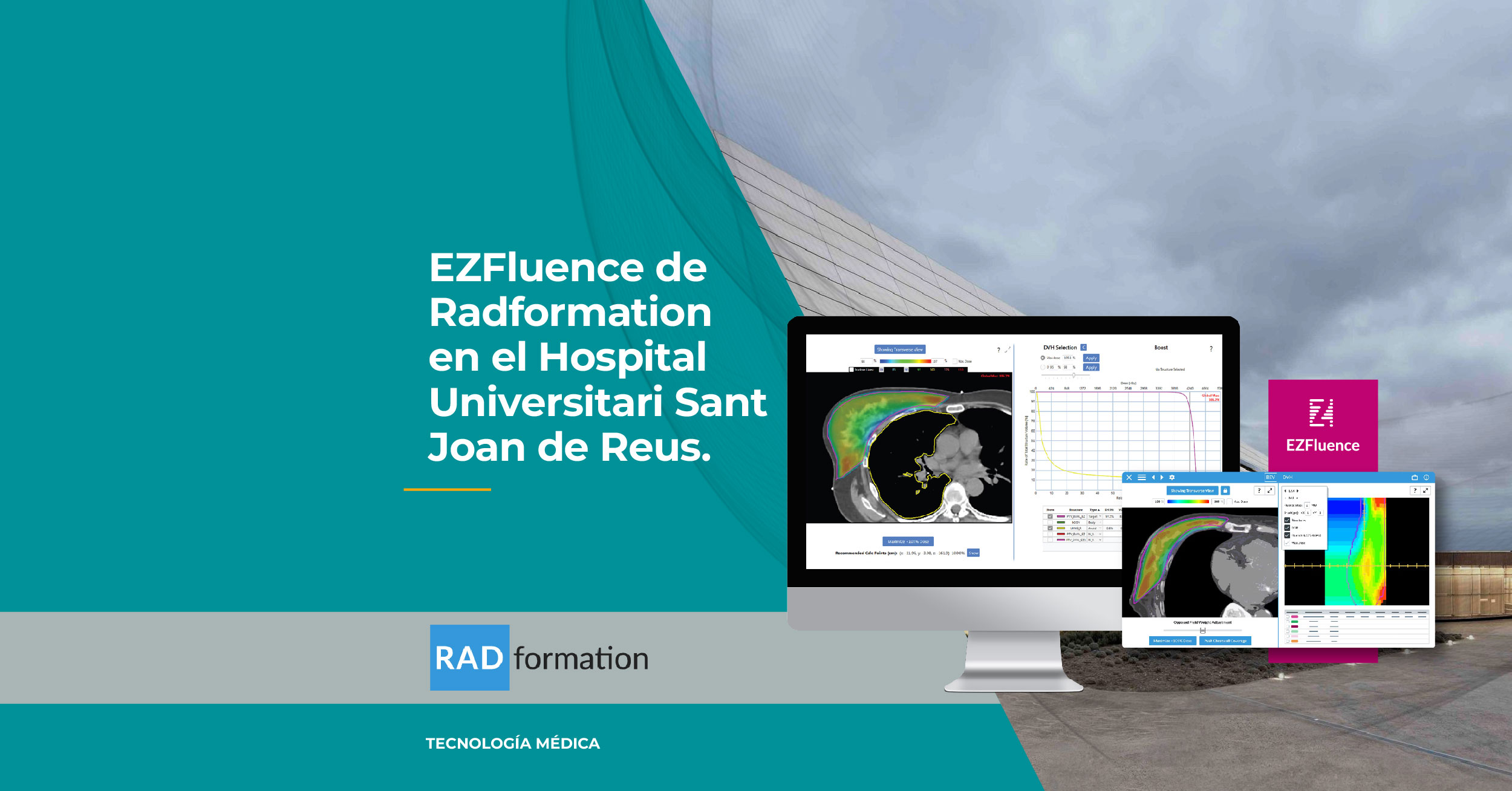 Planificación de radioterapia con Radformation en Reus - ATFísica